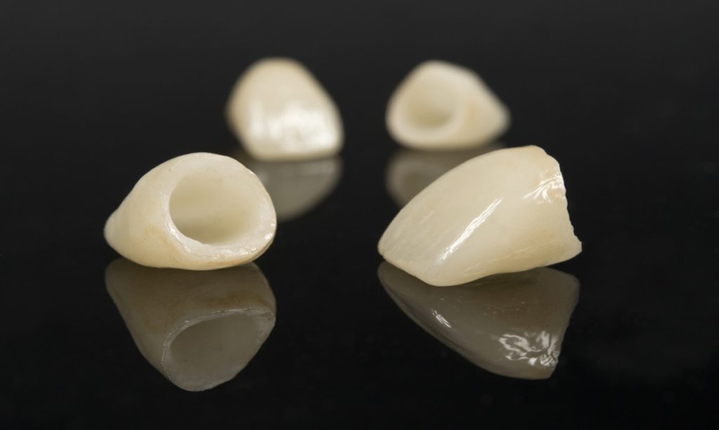 Five Ways To Protect Your Dental Crowns